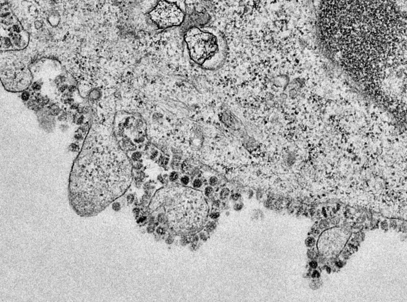 Viruses, the Virosphere and Astrovirology – Many Worlds